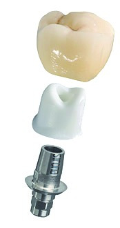 Arcade Dentaire - Tibase + vis DENTSPLY SIRONA - FX 3.4 S